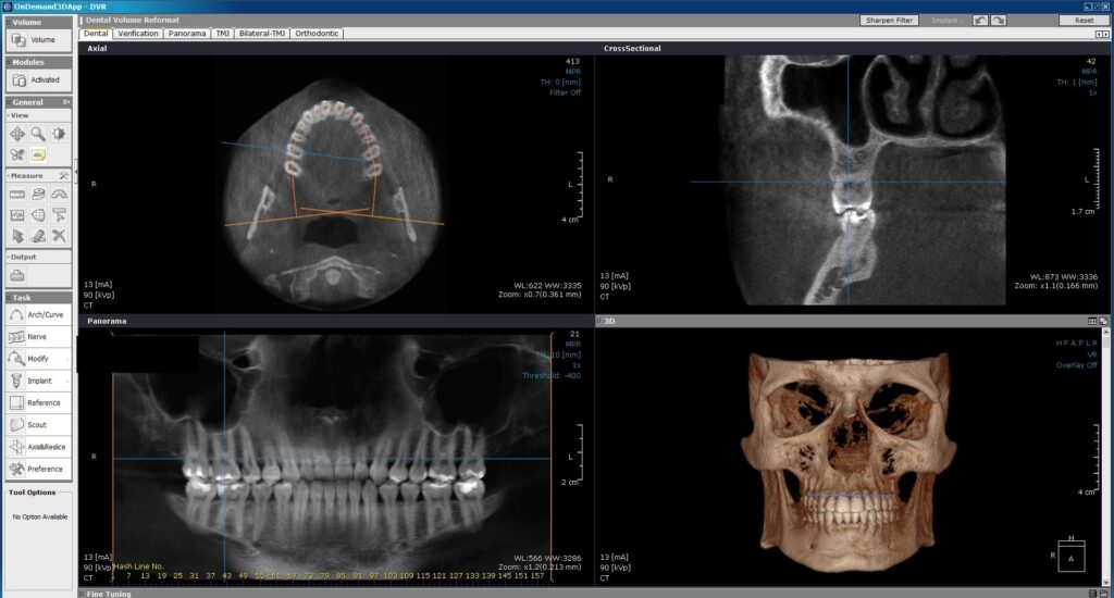 Rendgen - Stomatologija Milosavljević